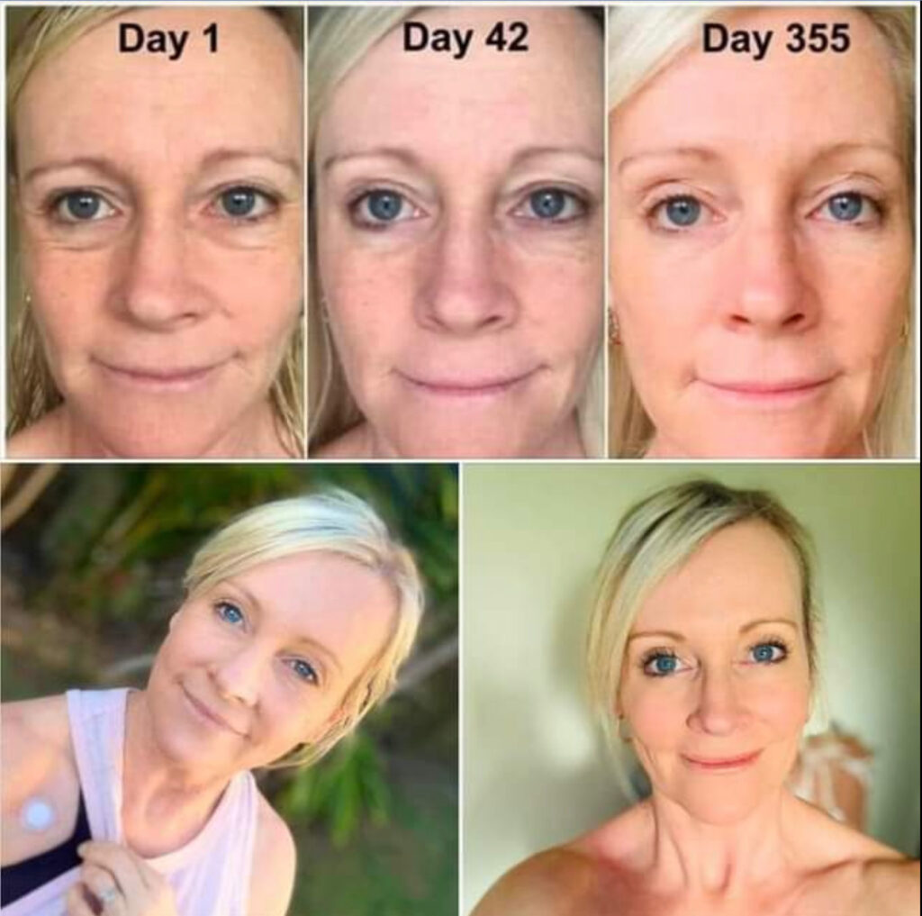 The power of phototherapy | Miraculous Patch